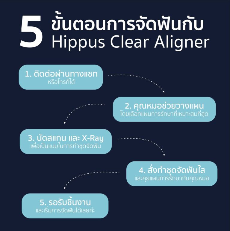 จัดฟันกับ Hippus ง่ายๆด้วย 5 ขั้นตอนนี้ - Hippus Clear Aligner