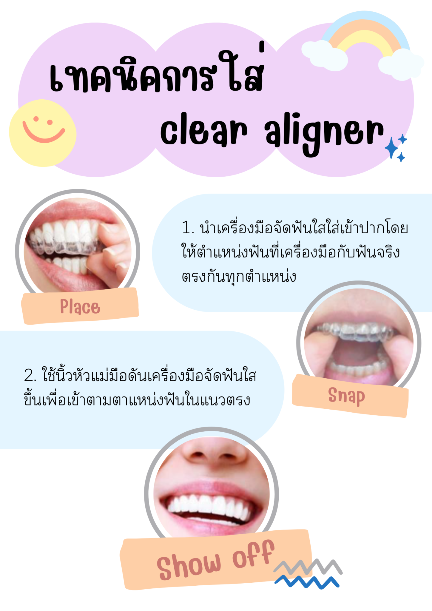 วิธีการใส่ถอด CA - Hippus Clear Aligner