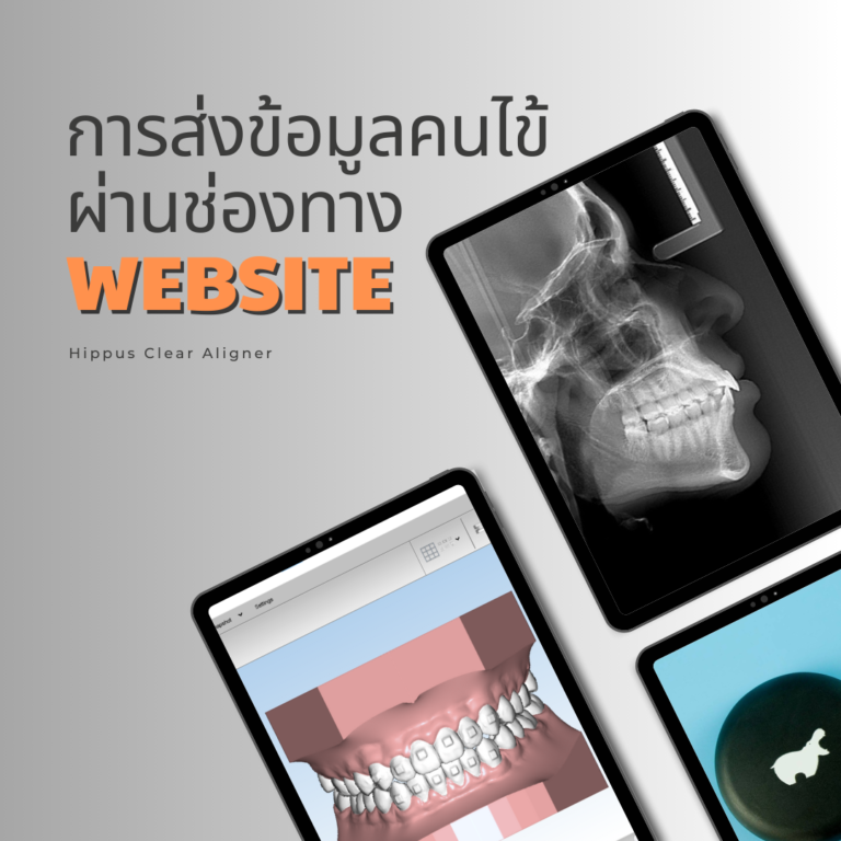 VDO การส่งข้อมูลคนไข้ผ่านช่องทาง Website - Hippus Clear Aligner